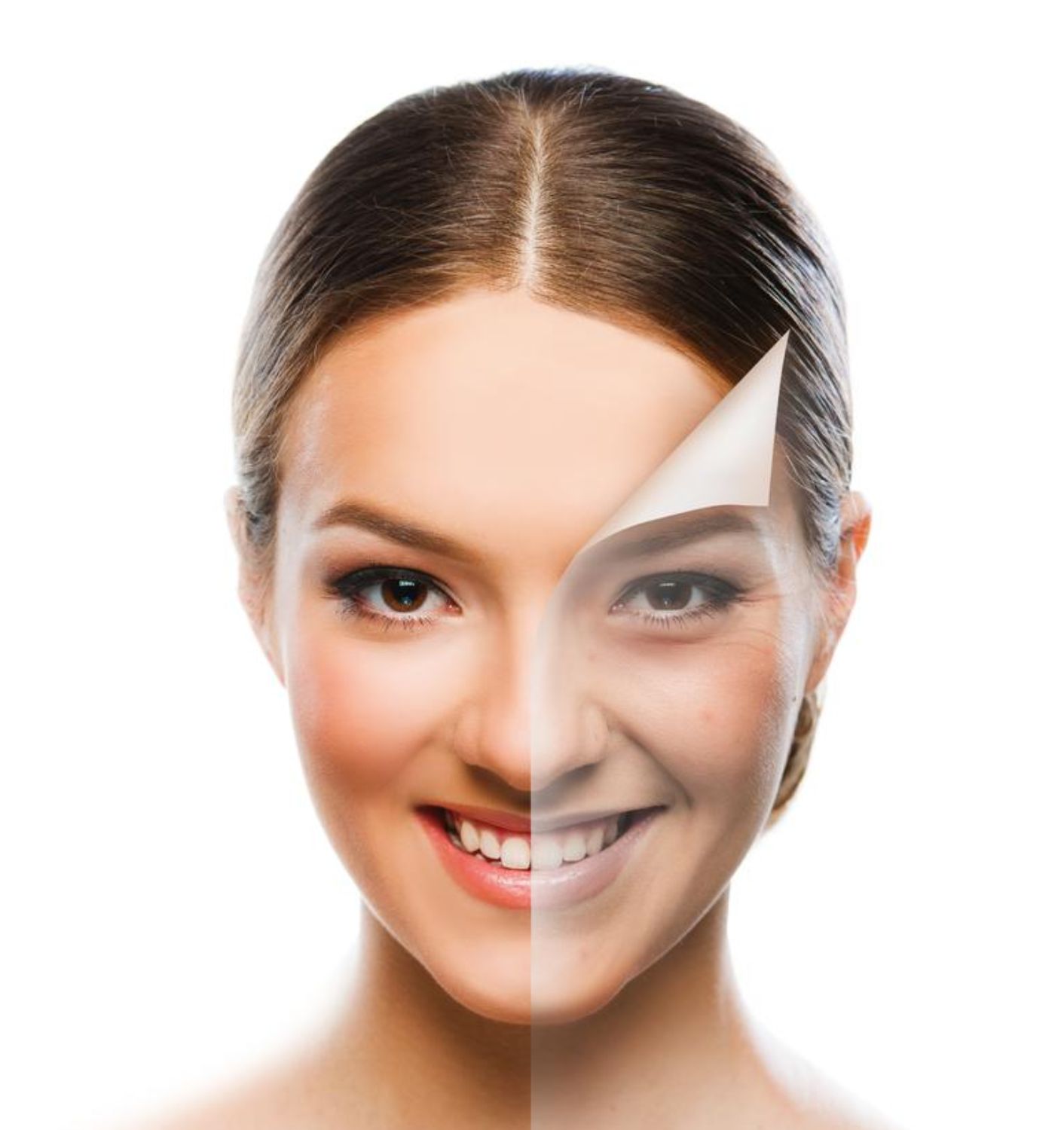 Advance Skin Peels